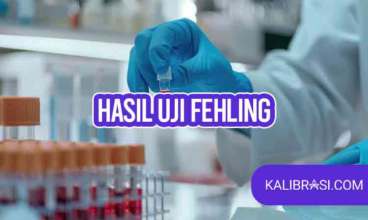 Cara Membaca Hasil Uji Fehling Dan Faktor Pentingnya!