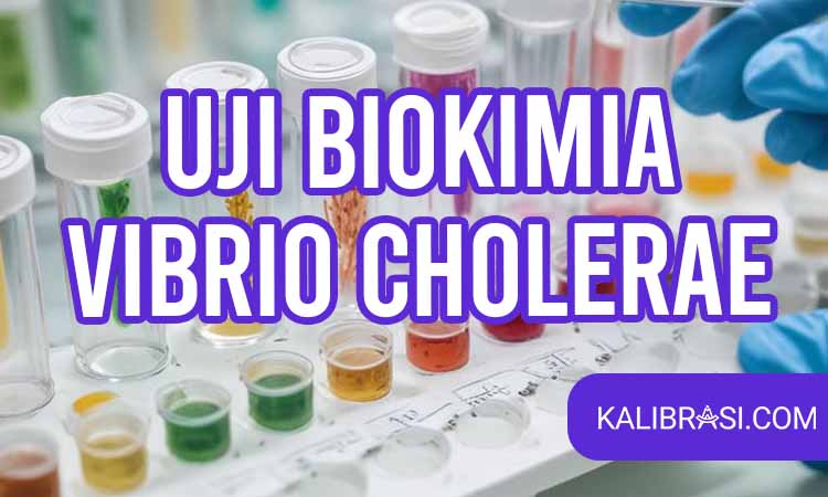 Uji Biokimia Vibrio Cholerae : Tujuan, Manfaat, Metode, Dan Karakteristik